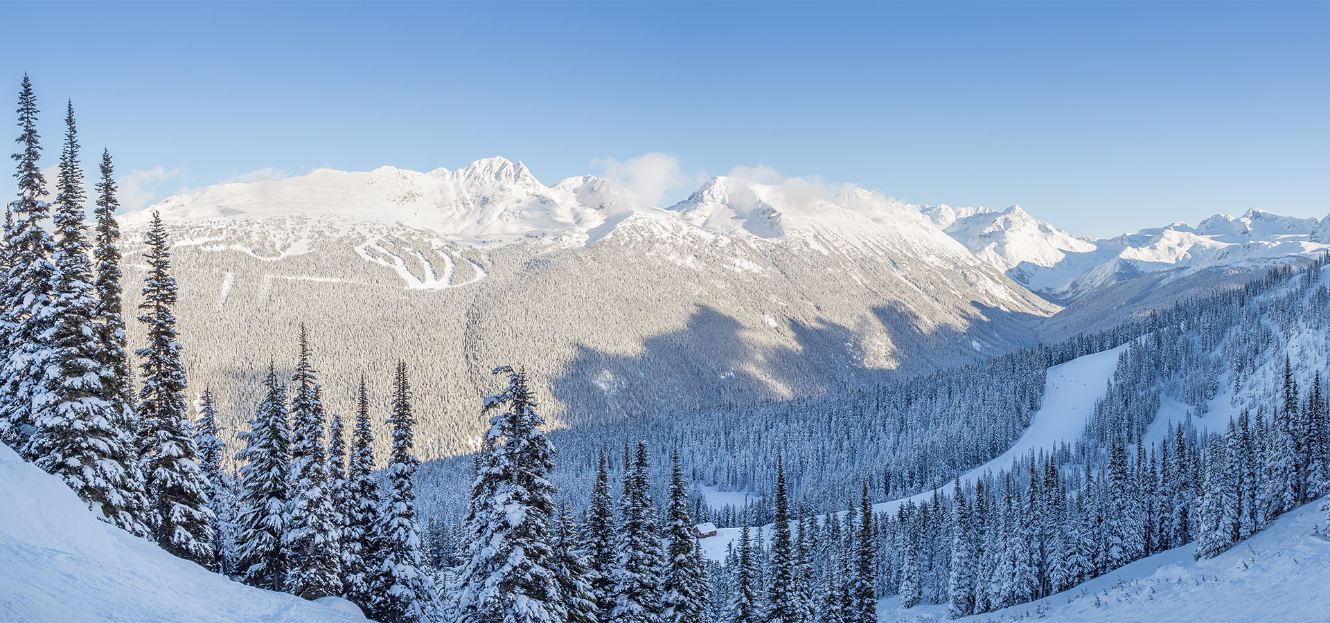 CHILDREN - Whistler Dental